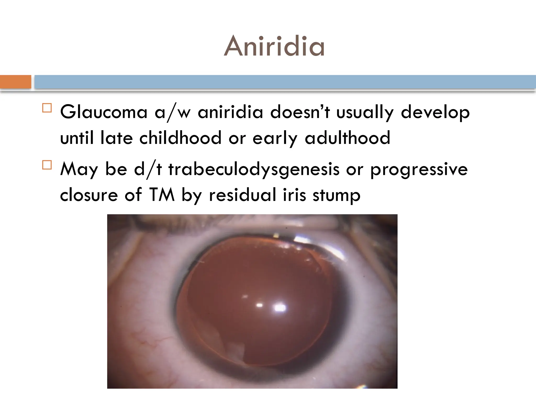 CLASSIFICATION OF GLAUCOMA (including Paediatric Glaucoma).pptx