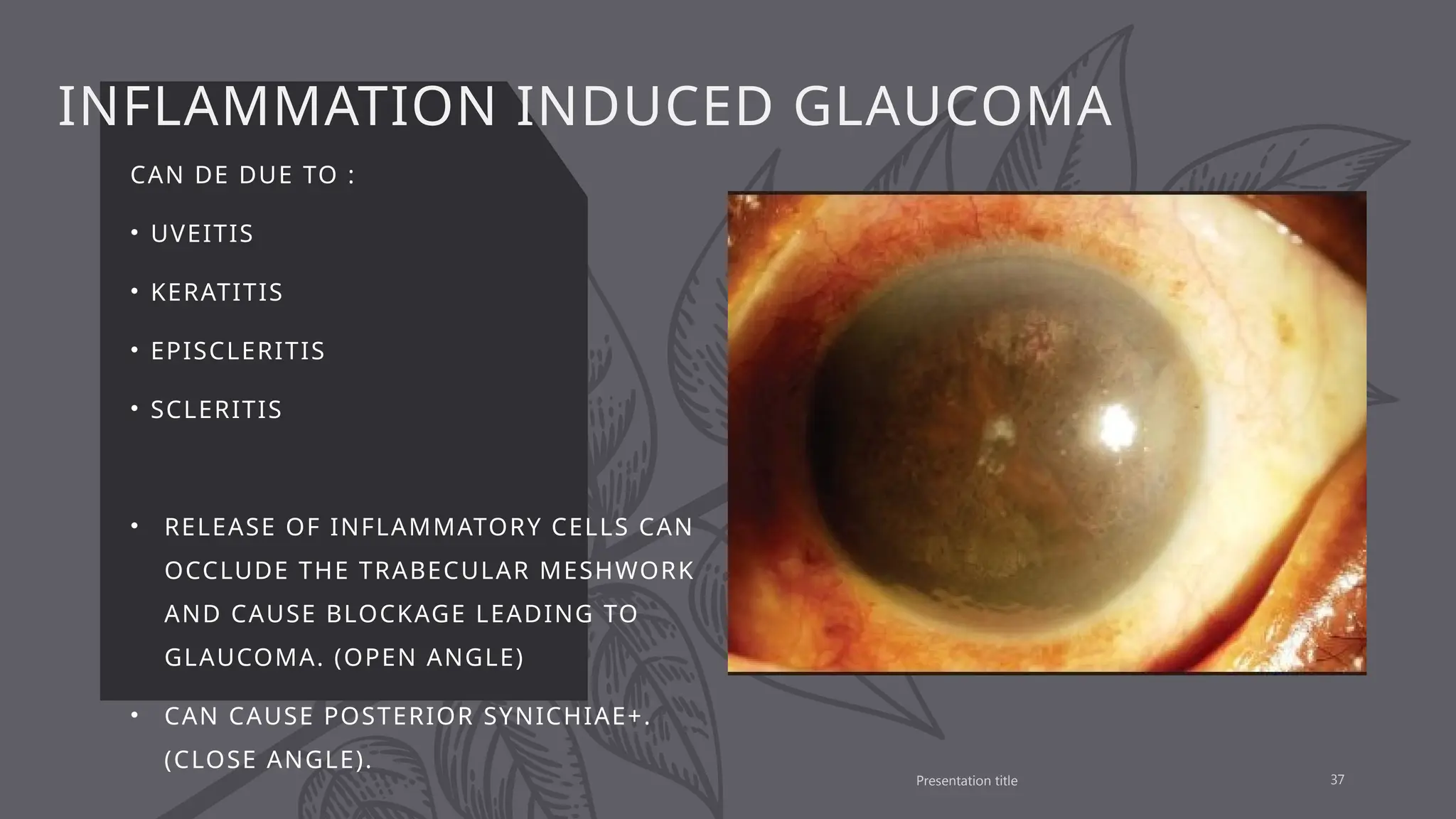 General Classification Of GLAUCOMA..pptx