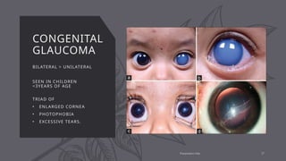 General Classification Of GLAUCOMA..pptx