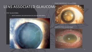 General Classification Of GLAUCOMA..pptx