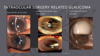 General Classification Of GLAUCOMA..pptx