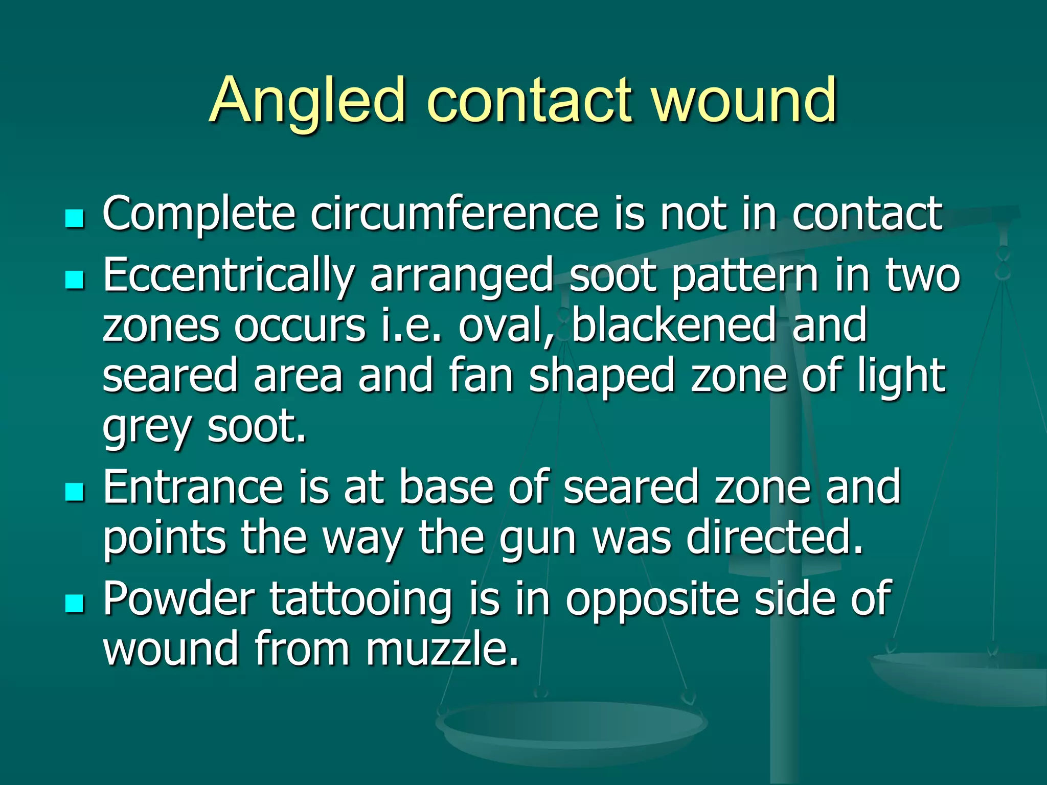 Classification of gunshot wounds | PPTX