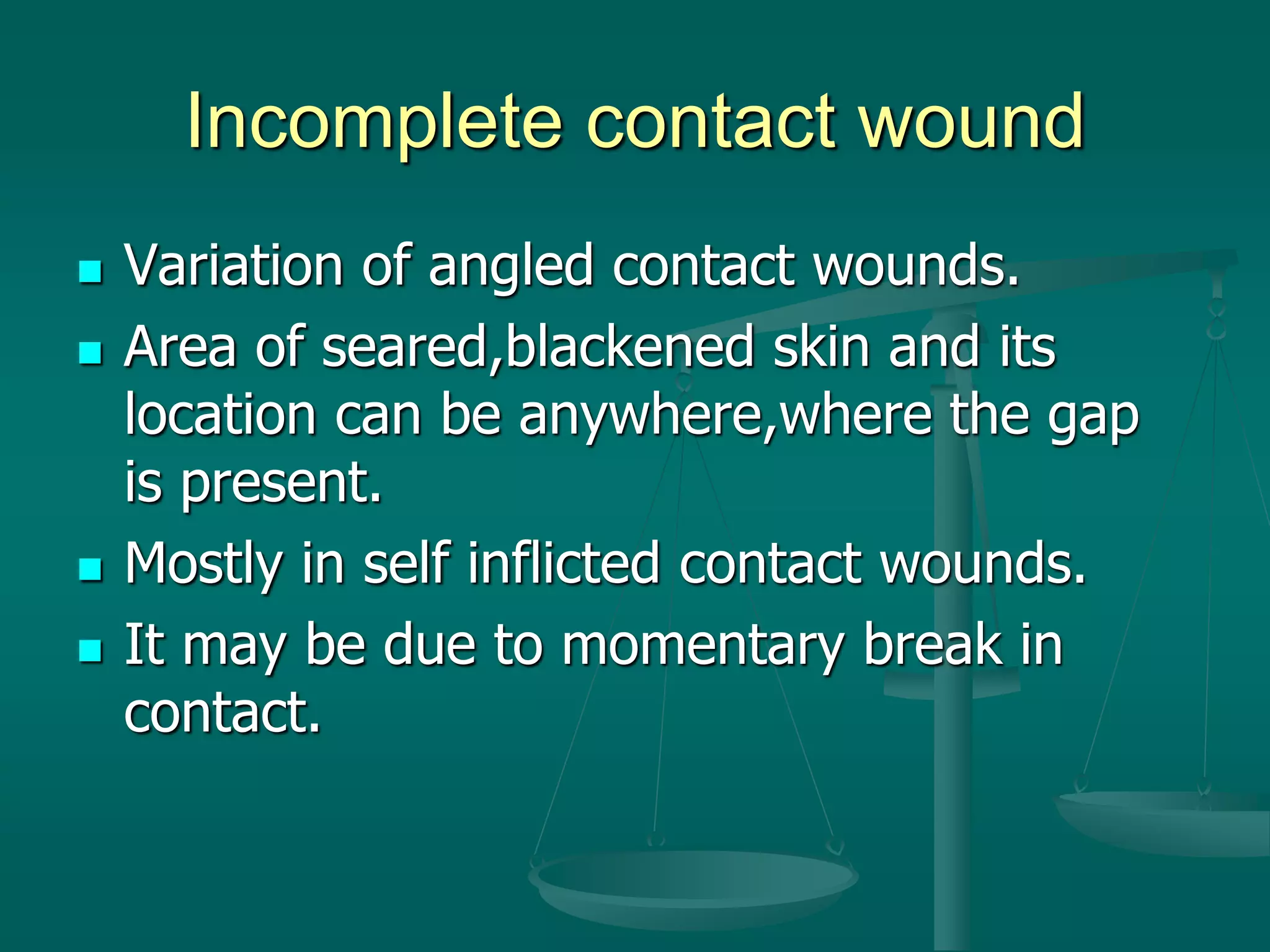 Classification of gunshot wounds | PPTX