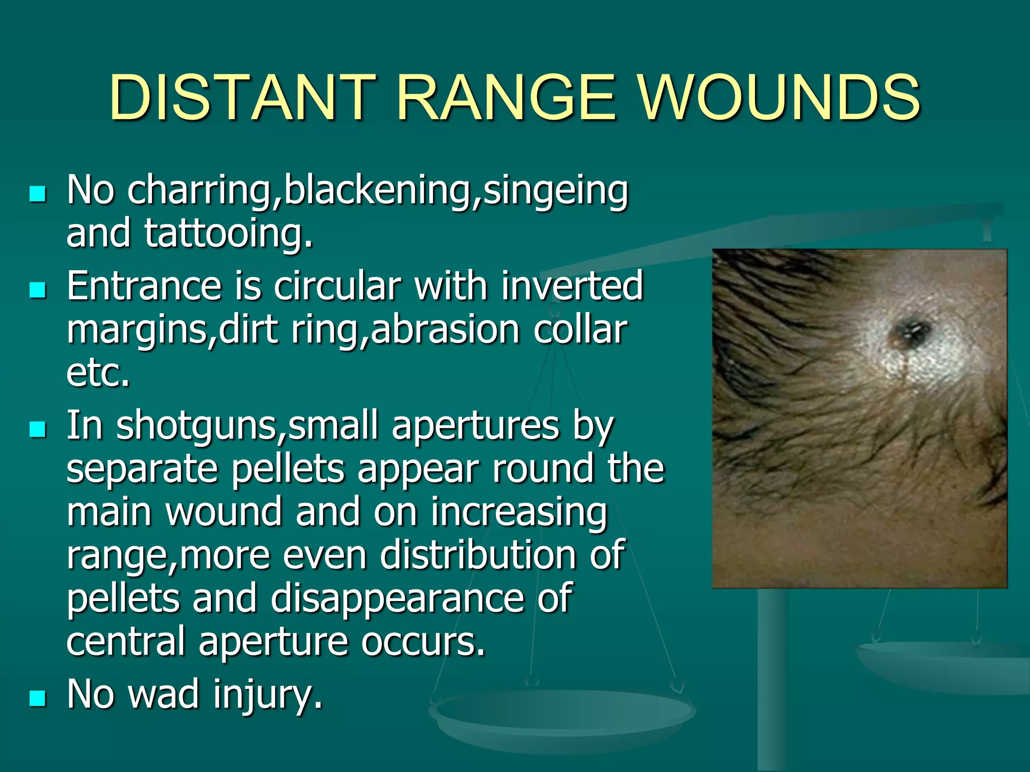 Classification of gunshot wounds | PPTX