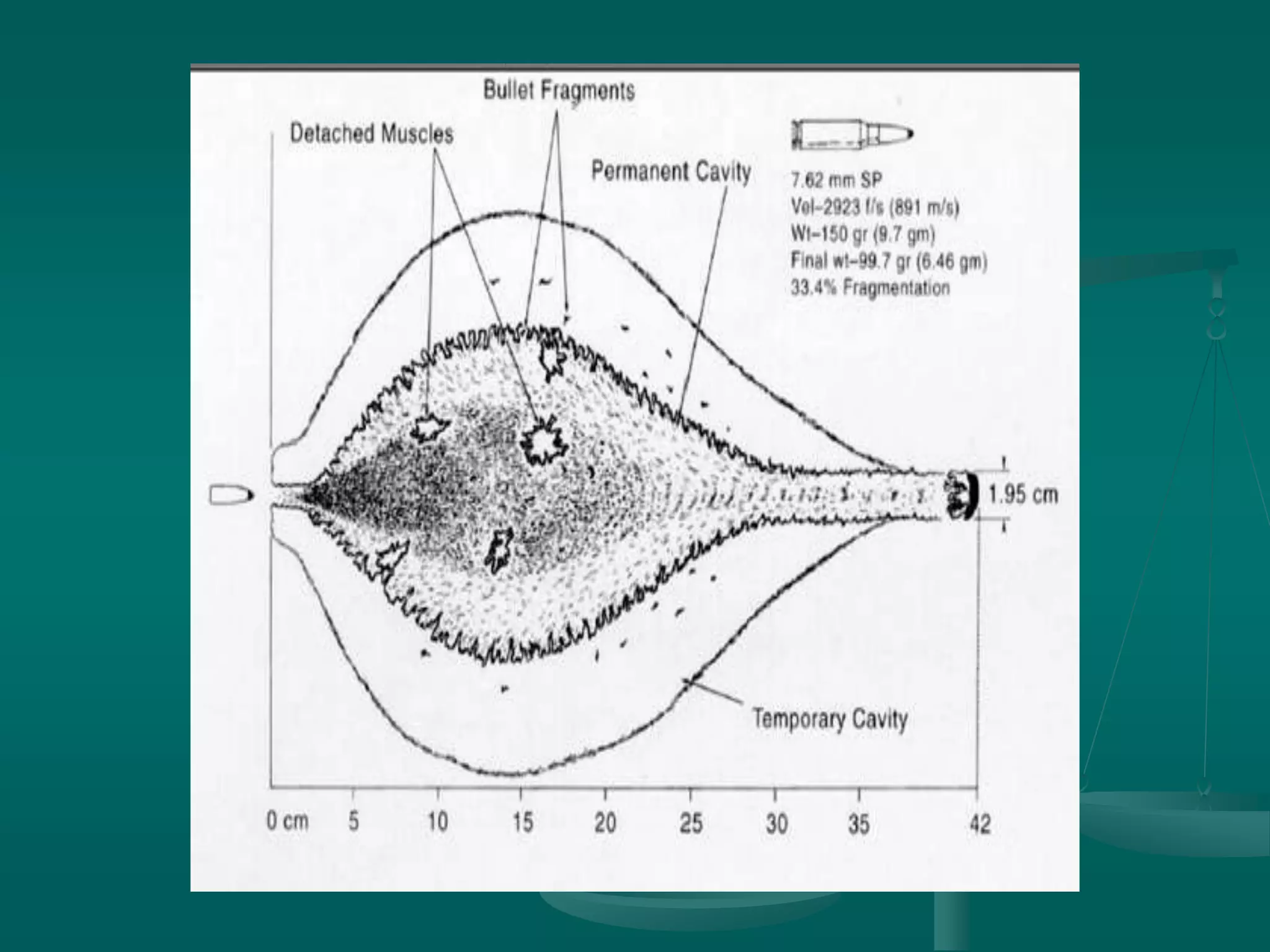 Classification of gunshot wounds | PPTX