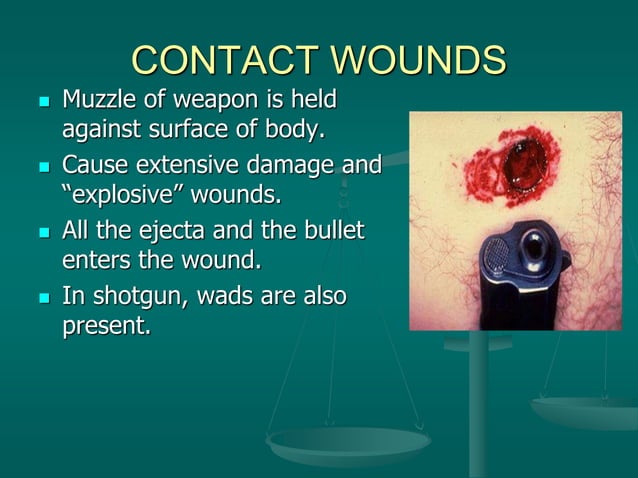 Classification of gunshot wounds | PPTX