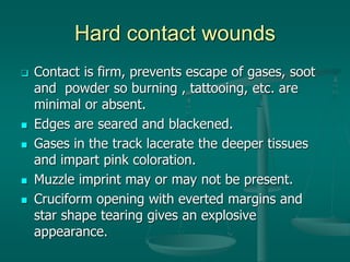 Classification of gunshot wounds | PPTX