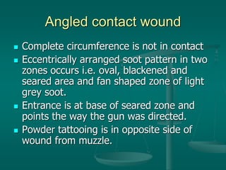 Classification of gunshot wounds | PPTX