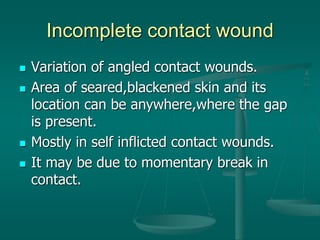 Classification of gunshot wounds | PPTX