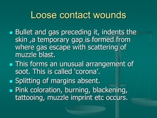 Classification of gunshot wounds | PPTX