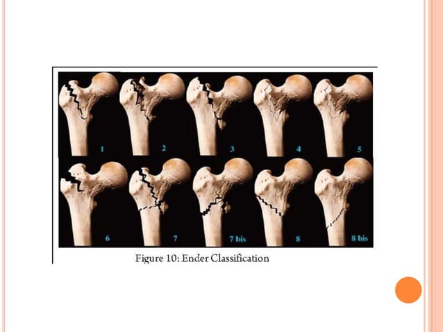 CLASSIFICATION OF IT-u2.pptx | Death, Injury, or Military Conflict ...