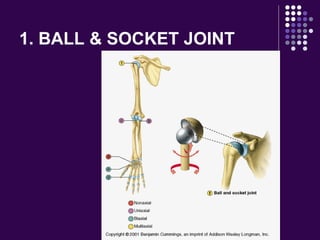 Plane Joint In The Arm