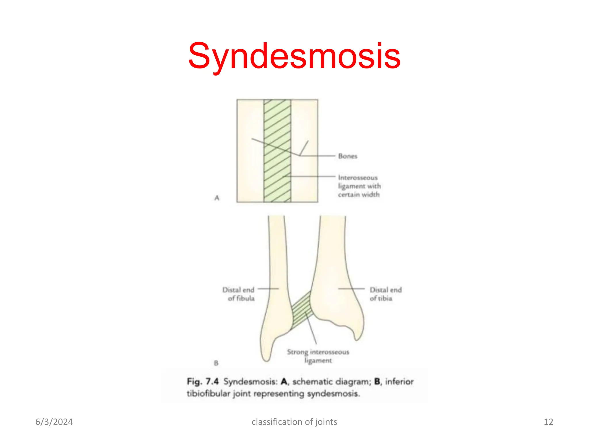 Classification of joints - general anatomy presentation | PPTX