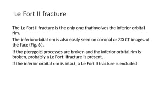 CLASSIFICATION OF LE FORT FRACTURE FDGHJHHC | PPT