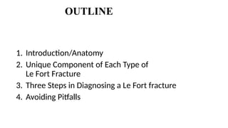 CLASSIFICATION OF LE FORT FRACTURE FDGHJHHC | PPT