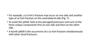 CLASSIFICATION OF LE FORT FRACTURE FDGHJHHC | PPT
