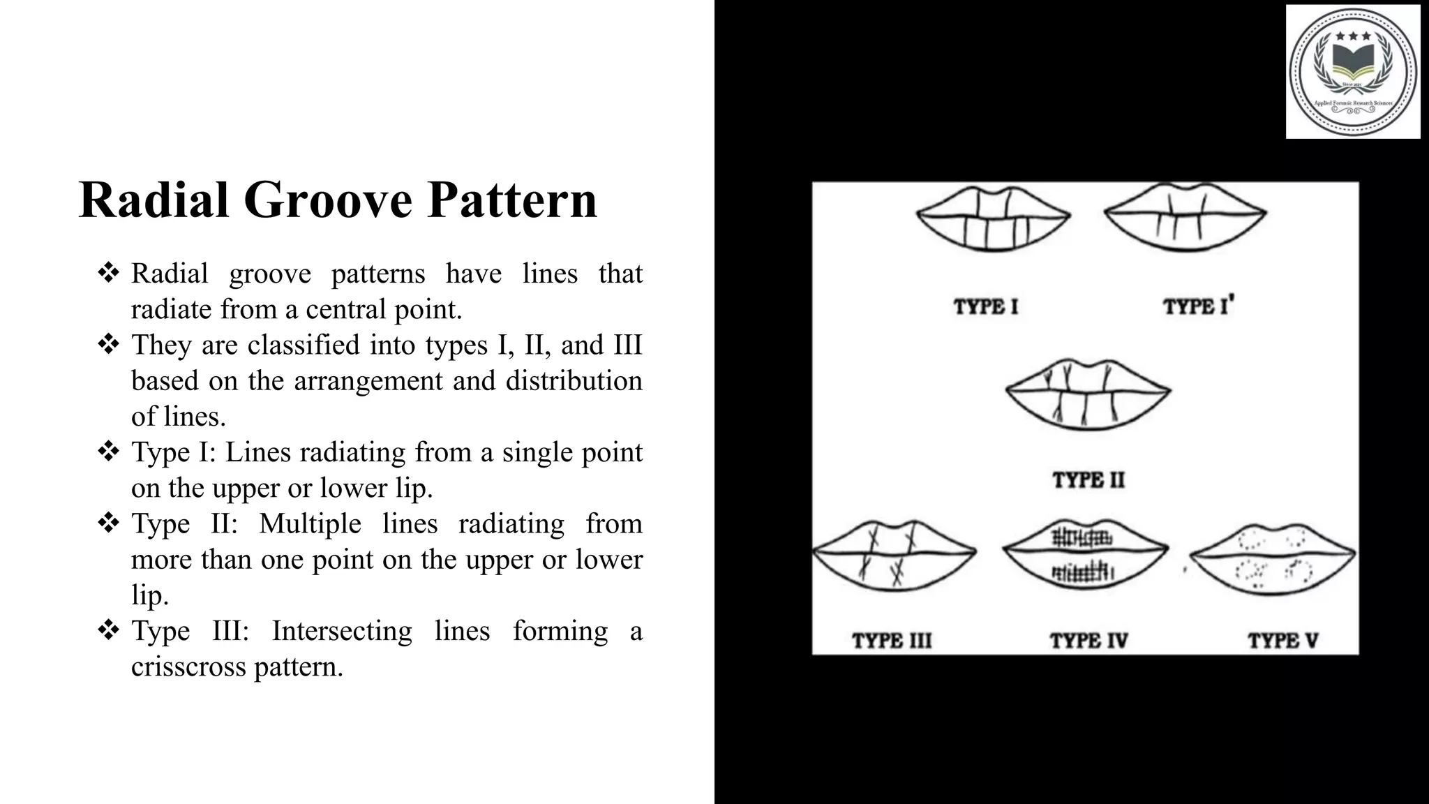 classification of lip prints | PPTX