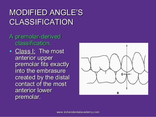 Classification of malocclusion