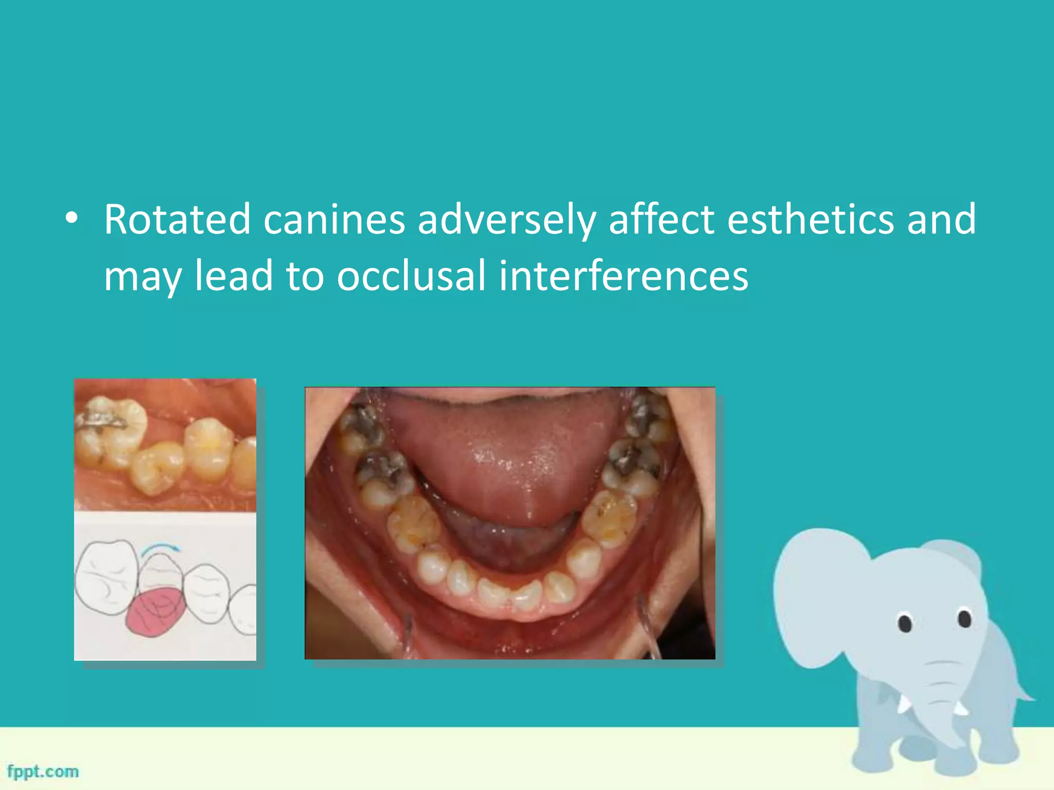 Classification of malocclusion in orthodontics | PPTX
