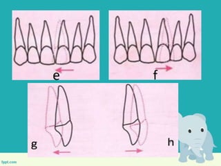 Classification of malocclusion in orthodontics | PPTX