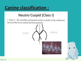 Classification of malocclusion in orthodontics | PPTX