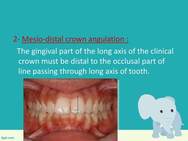 Classification of malocclusion in orthodontics