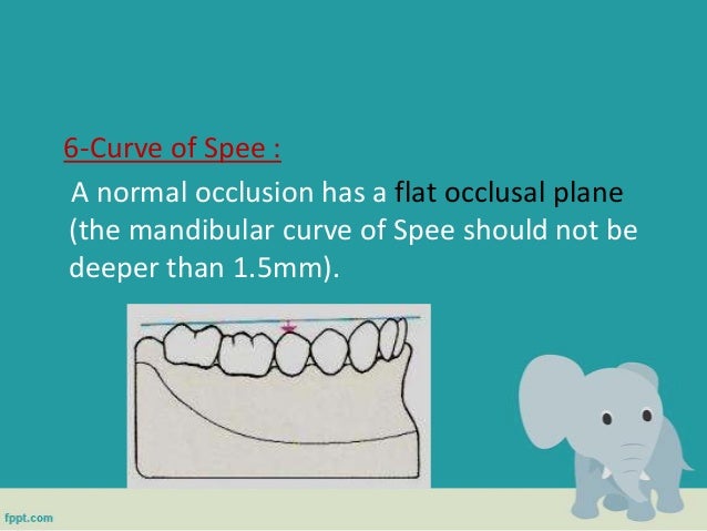 Classification of malocclusion in orthodontics
