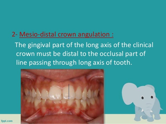Classification of malocclusion in orthodontics