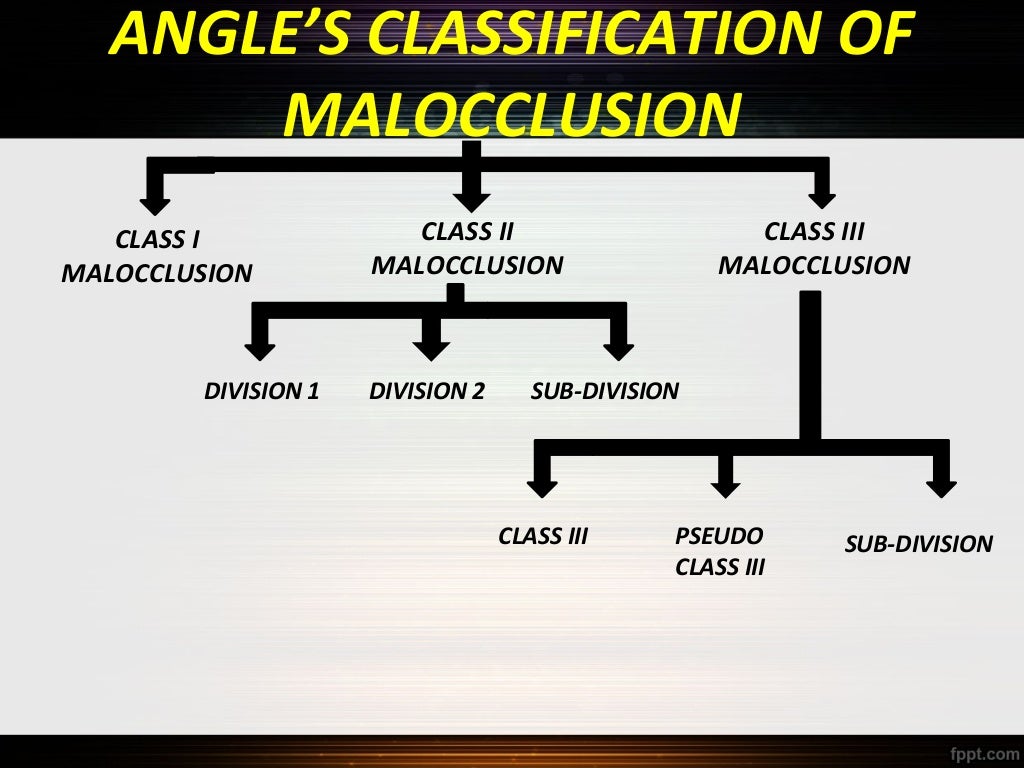 Classification of malocclusion