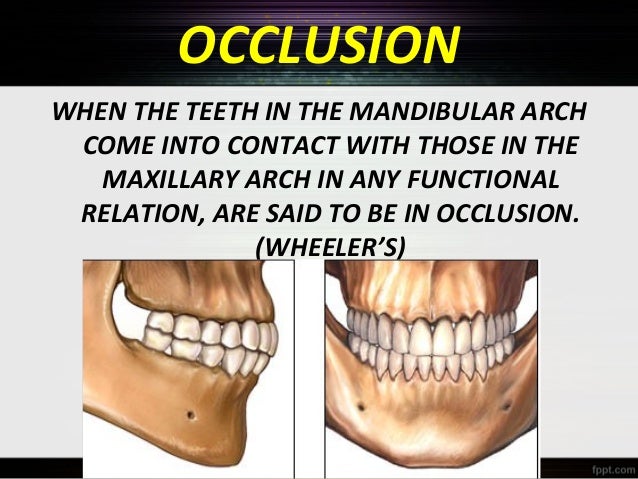 Classification of malocclusion