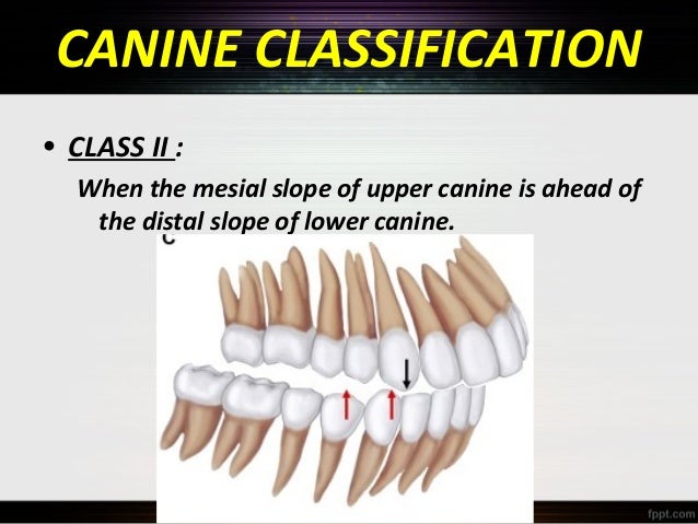 Classification of malocclusion
