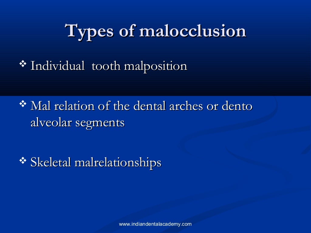Classification of malocclusion