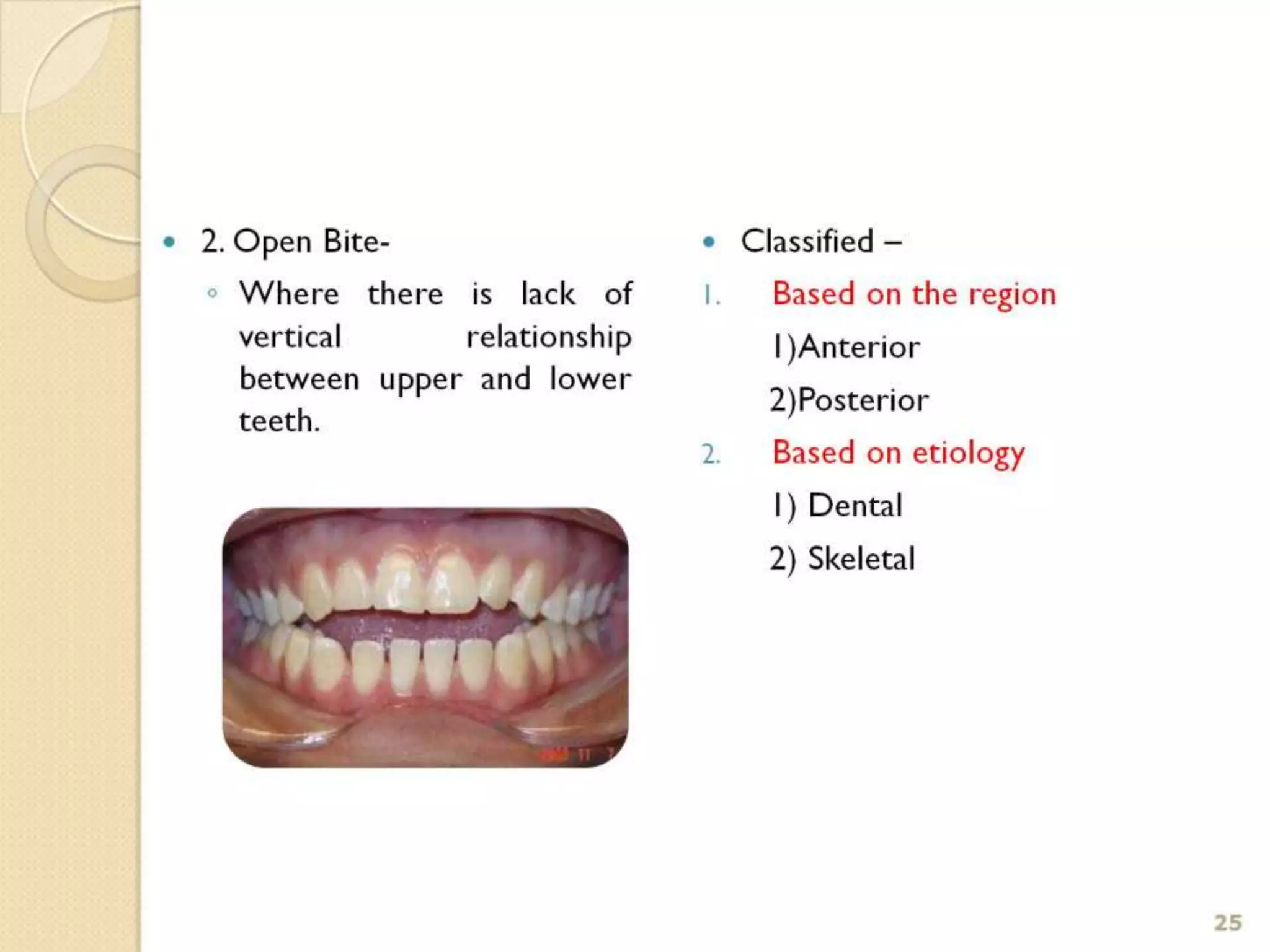 Classification of malocclusion | PPTX