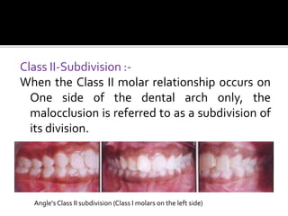 Classification of malocclusion | PPT