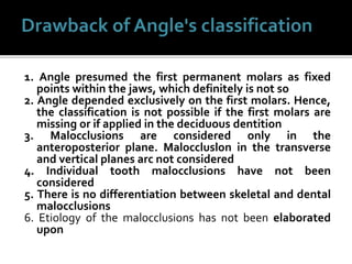 Classification of malocclusion | PPT