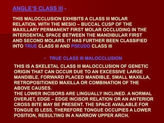 Classification of malocclusion | PPT