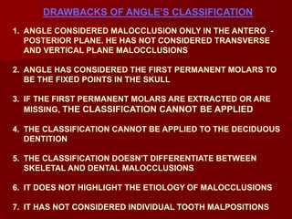 Classification of malocclusion | PPT