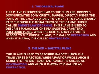 Classification of malocclusion | PPT