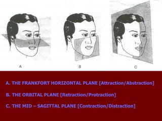 Classification of malocclusion | PPT