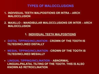 Classification of malocclusion | PPT