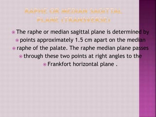 Classification ofmalocclusion | PPTX