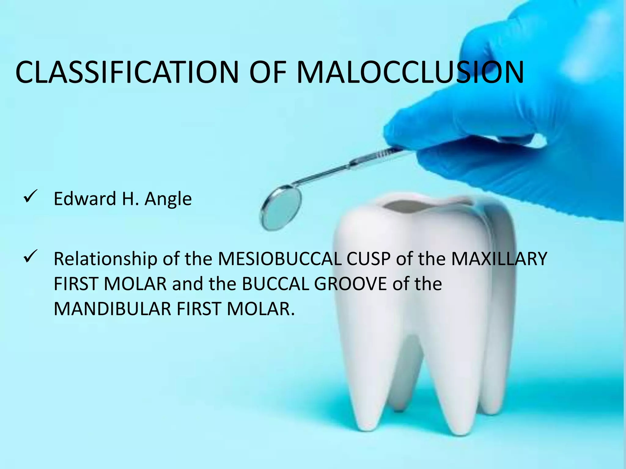 Classification of malocclusion | PPTX