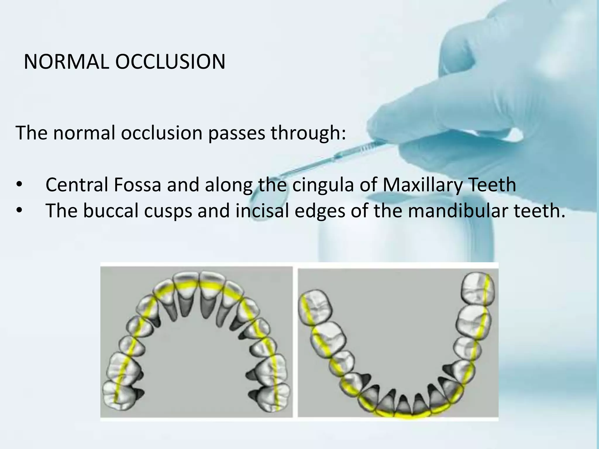 Classification of malocclusion | PPTX