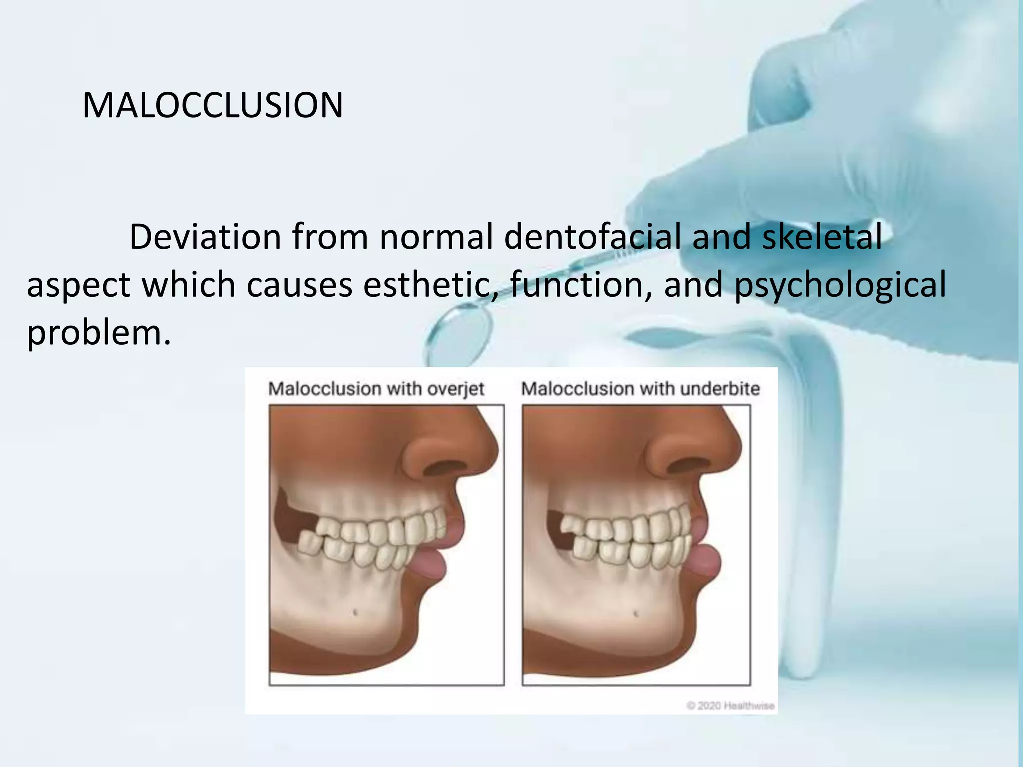 Classification of malocclusion | PPTX