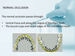 Classification of malocclusion | PPTX