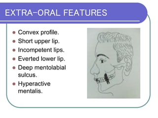CLASSIFICATION OF MALOCCLUSION.ppt