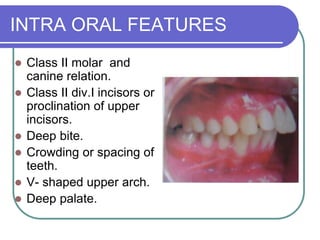 CLASSIFICATION OF MALOCCLUSION.ppt