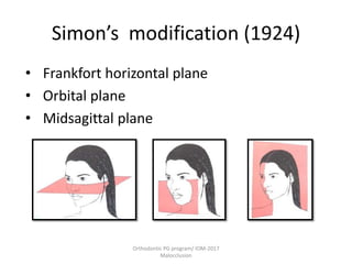 Classification of malocclusion.pptx