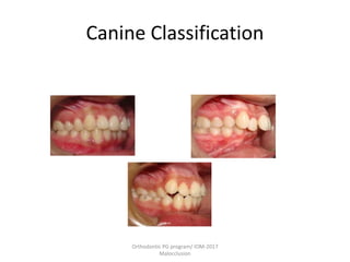 Classification of malocclusion.pptx