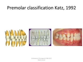Classification of malocclusion.pptx